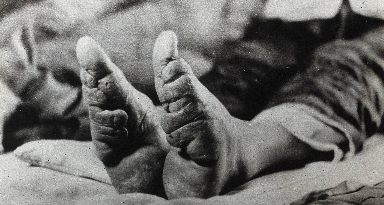 Meet The Last Woman Who Practiced Chinas 1000 Year Old Foot Binding