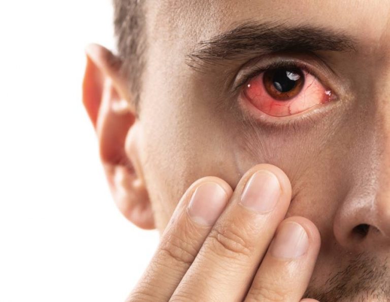12 Things Your Eyes Can Reveal About Your Health - PROVIDR